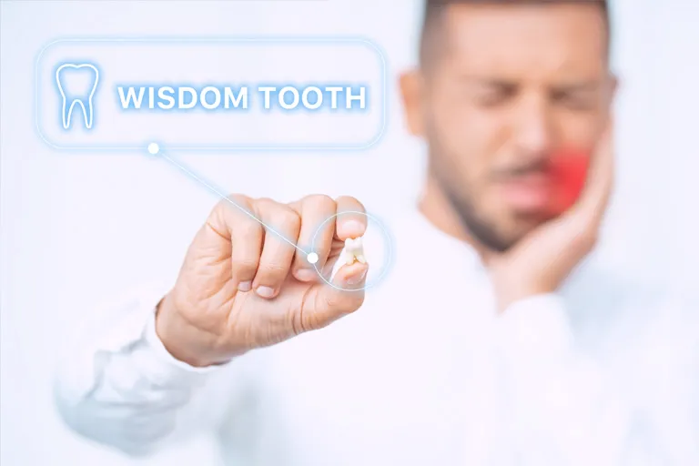 The Fascinating History Behind the Name "Wisdom Teeth"